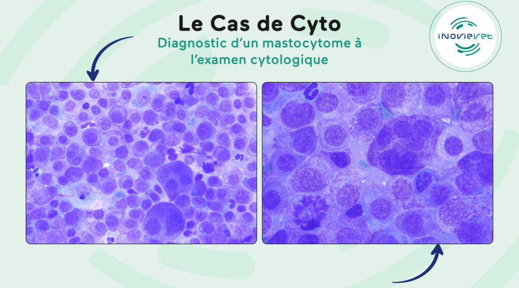 CAS DE CYTO : Le Dr Rivière vous explique un diagnostic surprenant ...