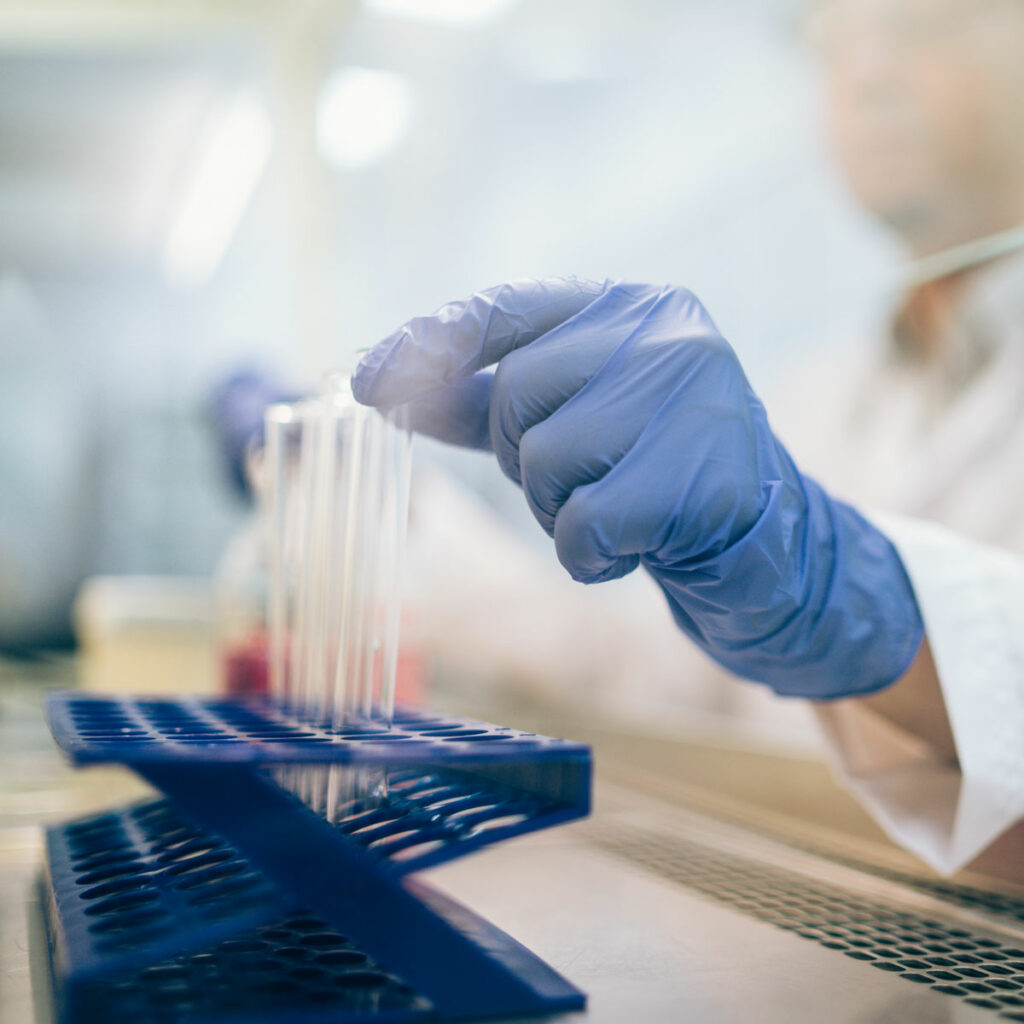 Envoyer mon prélèvement | Anydiag